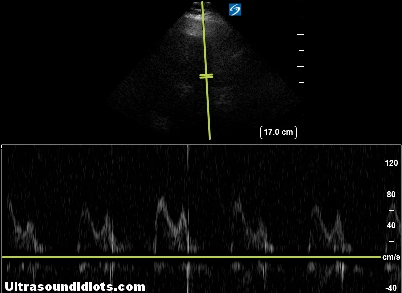 Ultrasound Idiots — limited echo (TTE) - Diagnostics