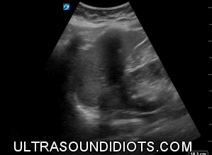 Trauma / EFAST — Ultrasound Idiots