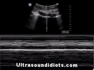 Trauma / EFAST — Ultrasound Idiots
