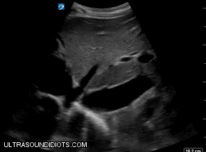 Ultrasound Idiots — Echocardiographic Exams
