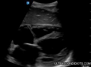 Ultrasound Idiots — Echocardiographic Exams