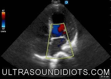 Echo Apical Exams — Ultrasound Idiots