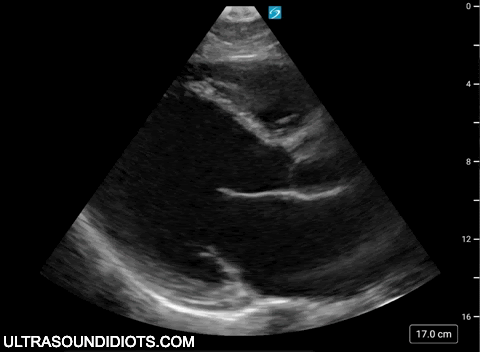 Ultrasound Idiots