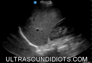 Ultrasound Idiots — Trauma / EFAST