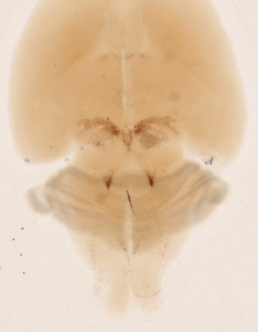 Beyond Color: The Hidden Impact of Neuromelanin In The Brain — WPC Blog