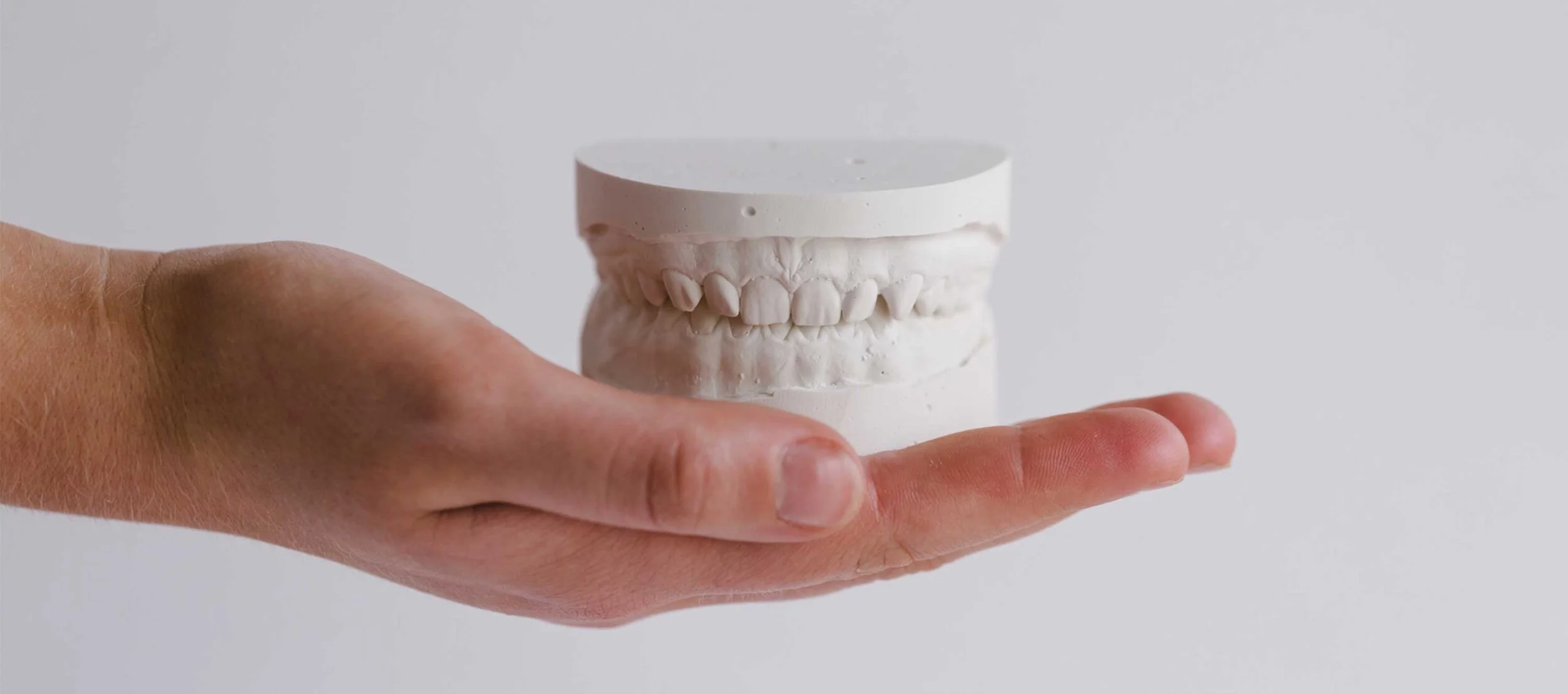 What is a Pulp Extirpation? — Emergency Dentist Sydney