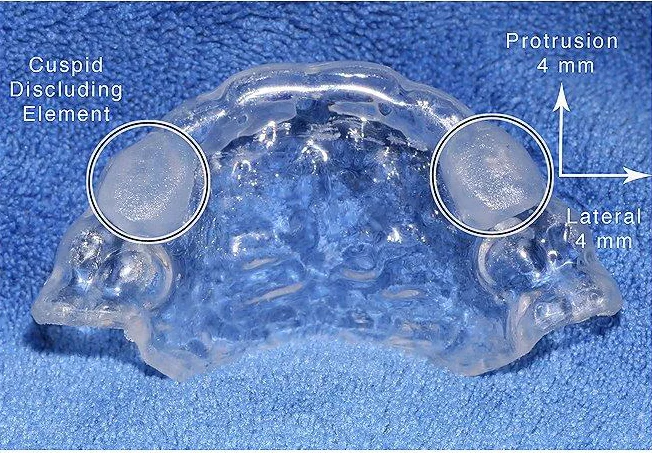 Functional Overlay — MAPA