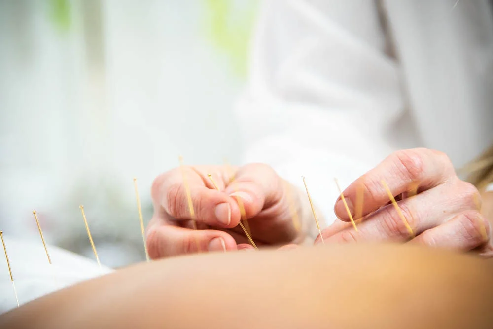How Acupuncture Works — Acutonix