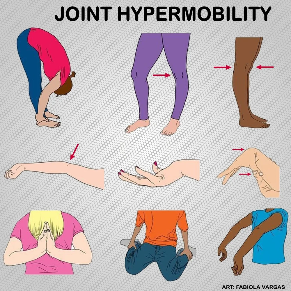 Hypermobility with Tanya Houpt — Body of Work