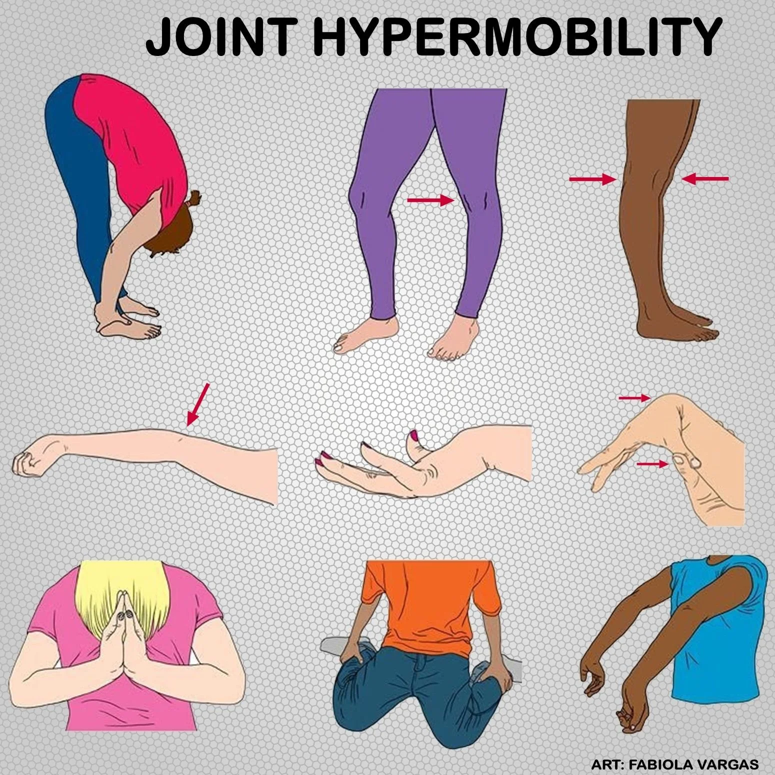 Hypermobility With Tanya Houpt Body Of Work