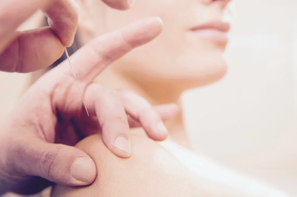 Dry Needling and IMS Physiotherapy Treatment