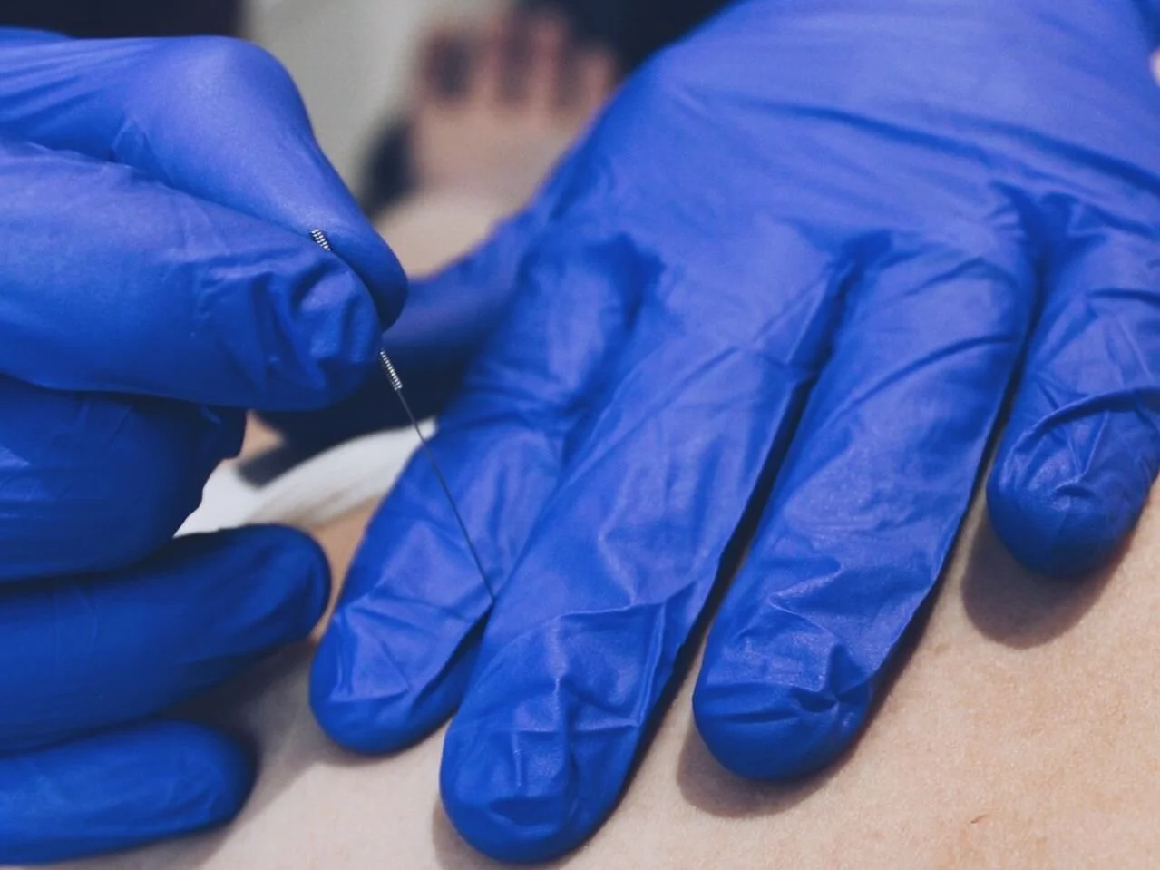 Rotator Cuff Injury Therapy