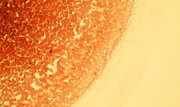 Dried Blood Analysis – a Holistic-Medical Blood Test