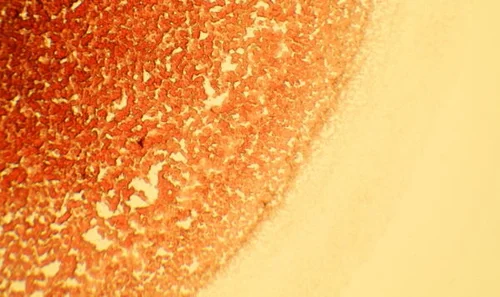 Dried Blood Analysis – a Holistic-Medical Blood Test