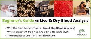 Dried Blood Analysis – a Holistic-Medical Blood Test