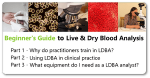 Dried Blood Analysis – a Holistic-Medical Blood Test