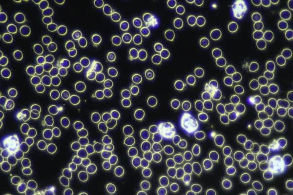 Euromex iScope for Live Blood Analysis