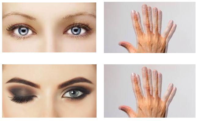 Double Vision (Diplopia): Causes, Symptoms & Treatment