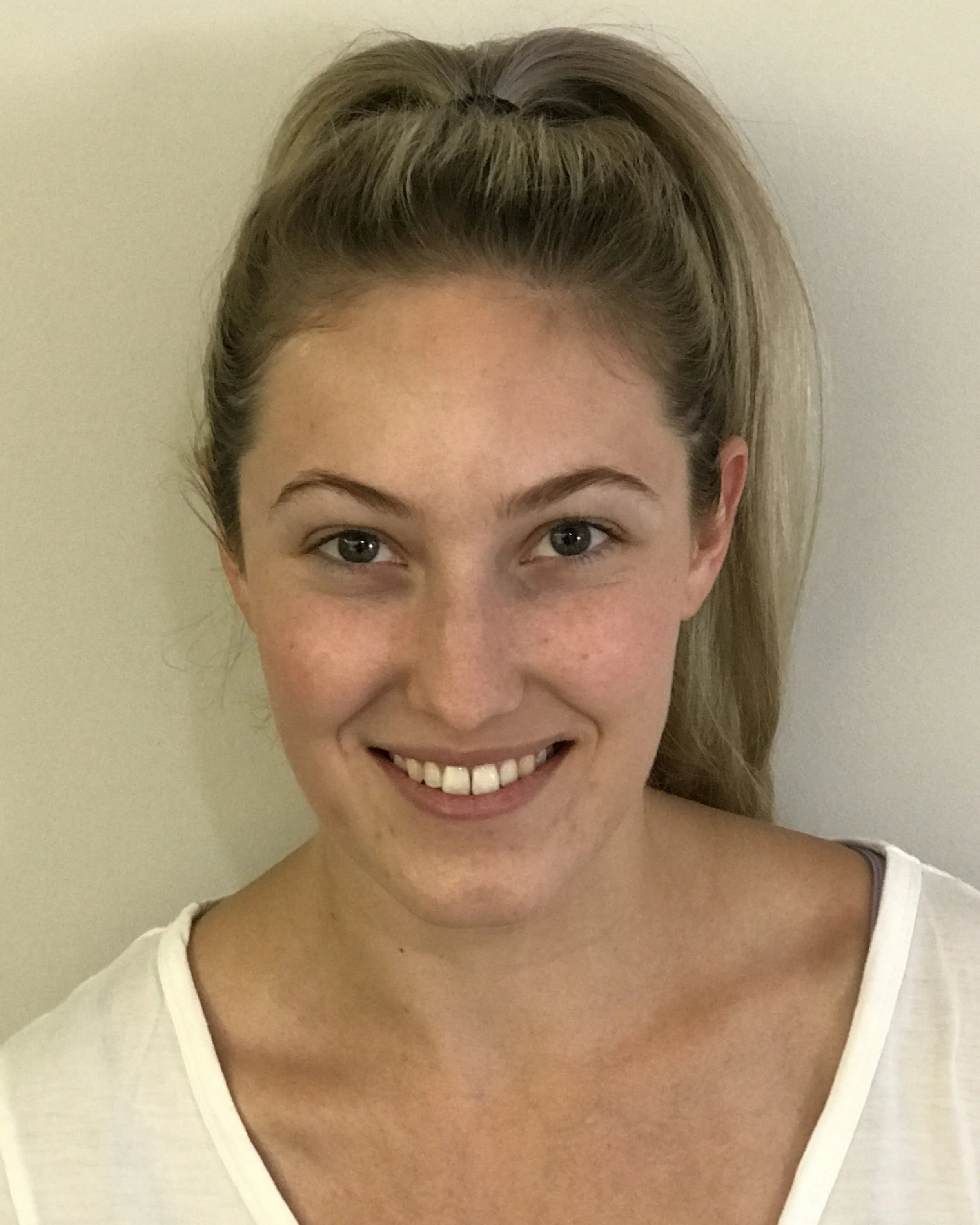 Team — Australian Laser Tech