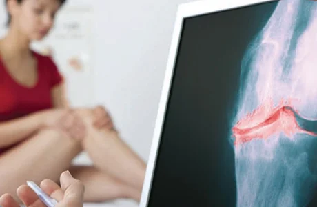 Radiofrequency Ablation — Pain Specialists Australia