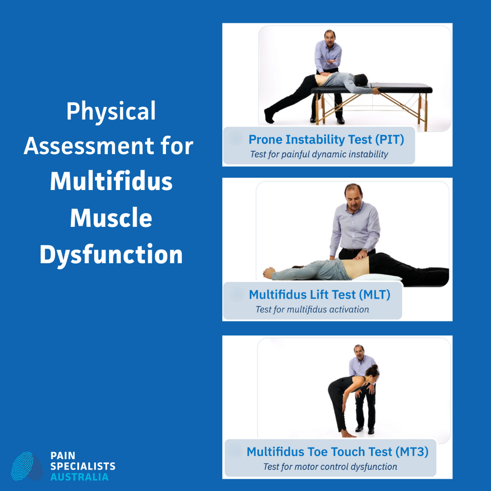 Multifidus Muscle Stimulation for Chronic Back Pain | Melbourne — Pain ...