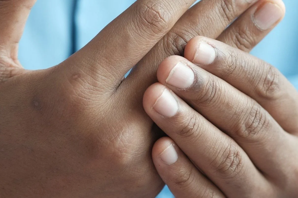 Arthritis Pain Relief and Management in Melbourne | Causes, Symptoms ...