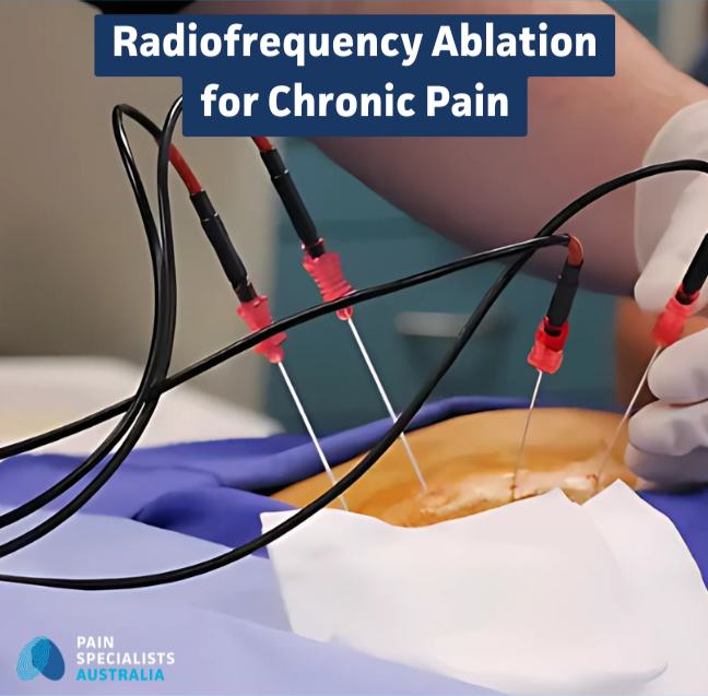 Facet Joint Injections and Radiofrequency Melbourne | Back Pain Experts ...