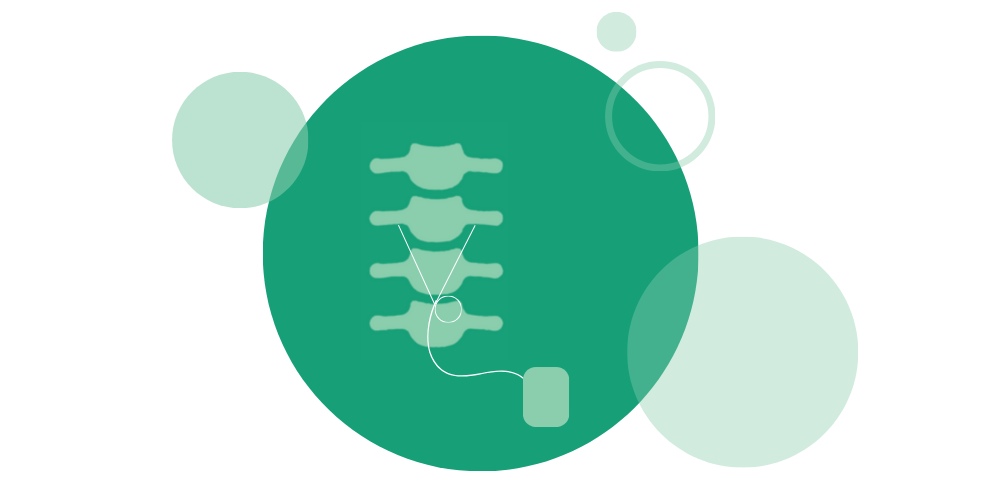 Treatments — Pain Specialists Australia