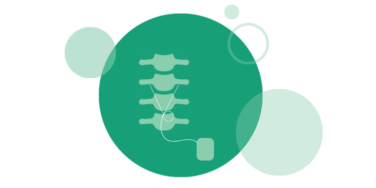 Treatments — Pain Specialists Australia