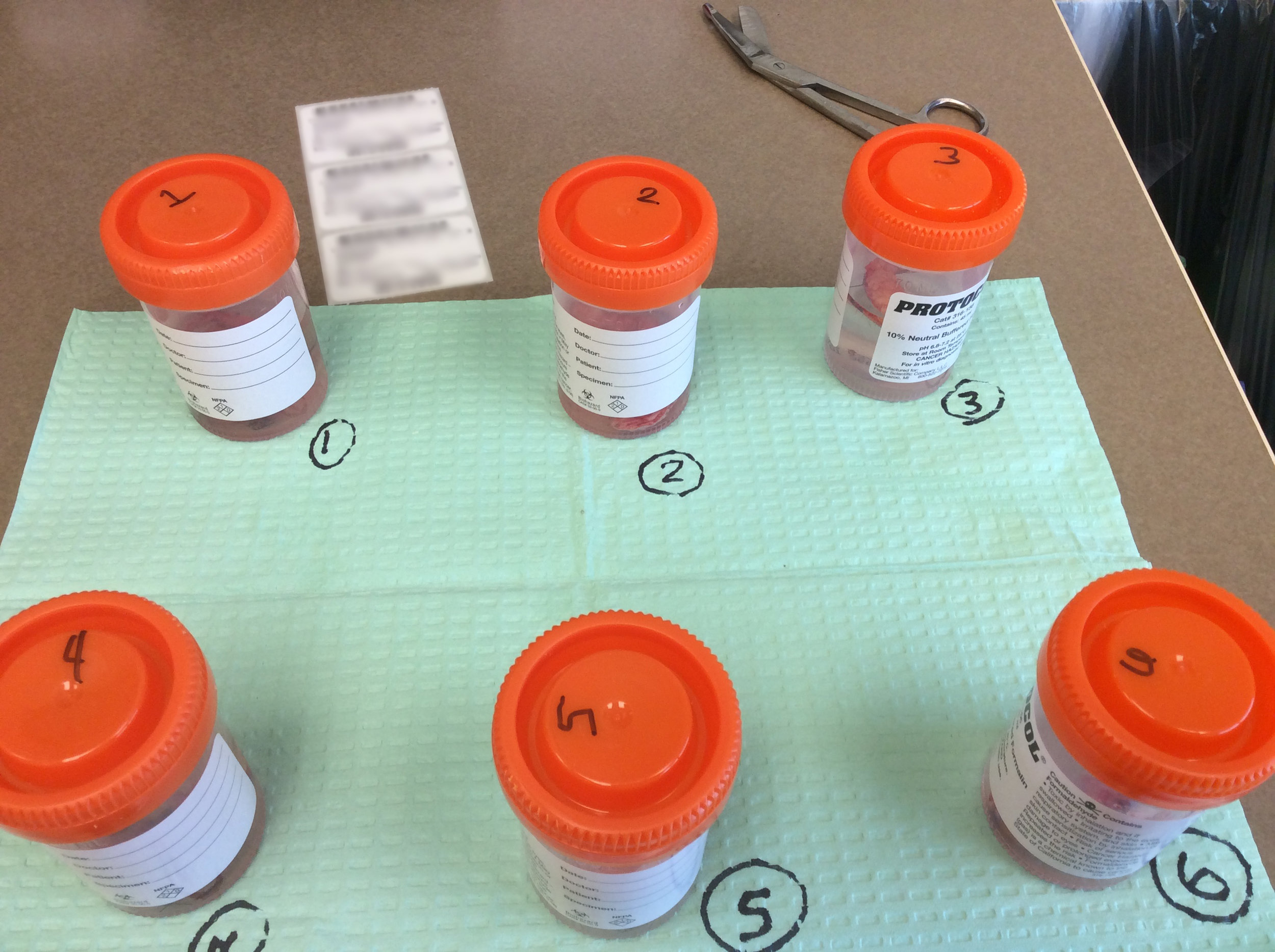 Extramammary Paget's Disease Photos — myEMPD.com