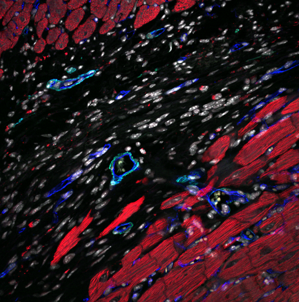 Cardiac Tissue Regeneration — The Monaghan Lab