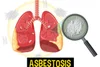 Seeking Compensation for Asbestos-Related Injuries? Here’s What You ...