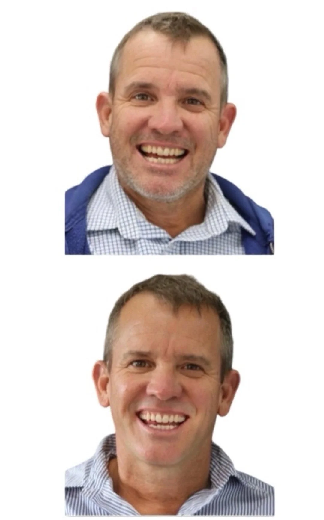 Brisbane Smile Boutique Dentists - Aesthetic Female Dentists in Spring ...