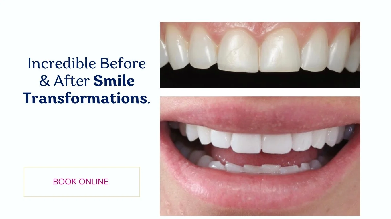 Brisbane Smile Boutique Dentists - Aesthetic Female Dentists in Spring ...