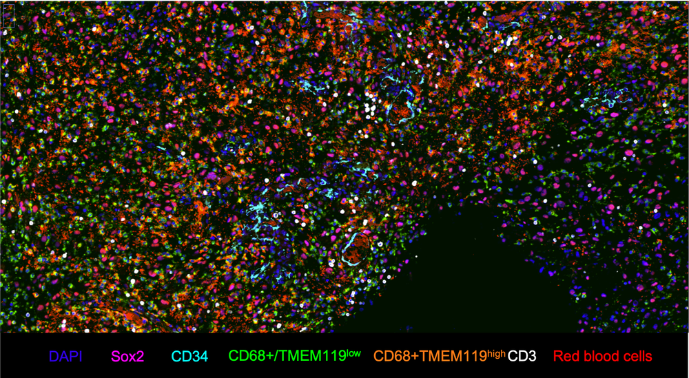 multiplexed IHC / MILAN — Laboratory for Precision Cancer Medicine