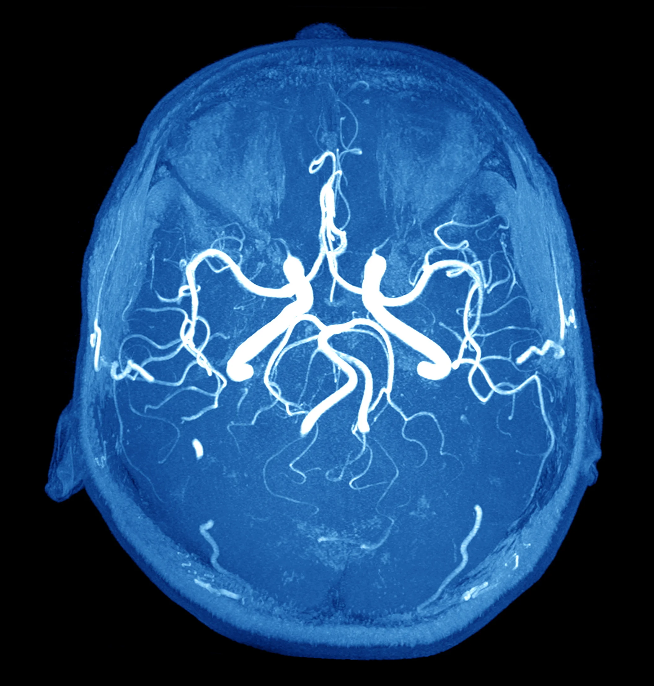Silicon Valley MRI & CT