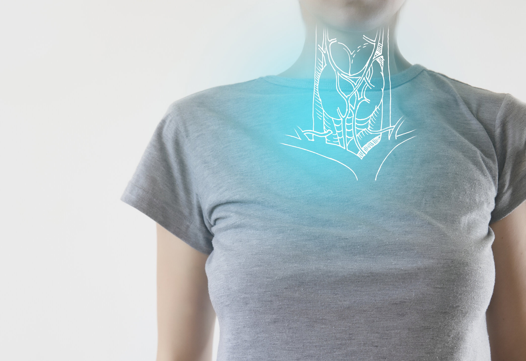 SiteOne Therapeutics