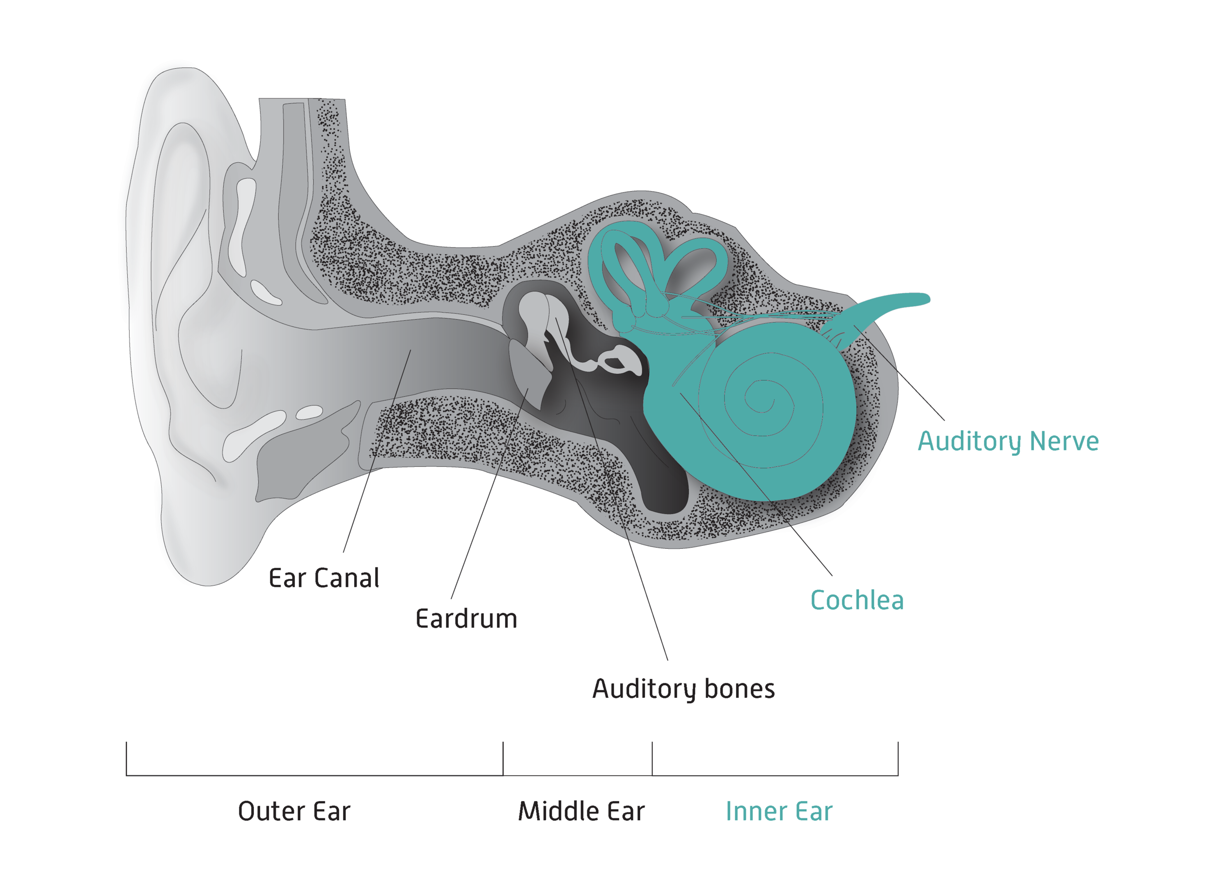 Types Of Hearing Loss Hearing Health Foundation