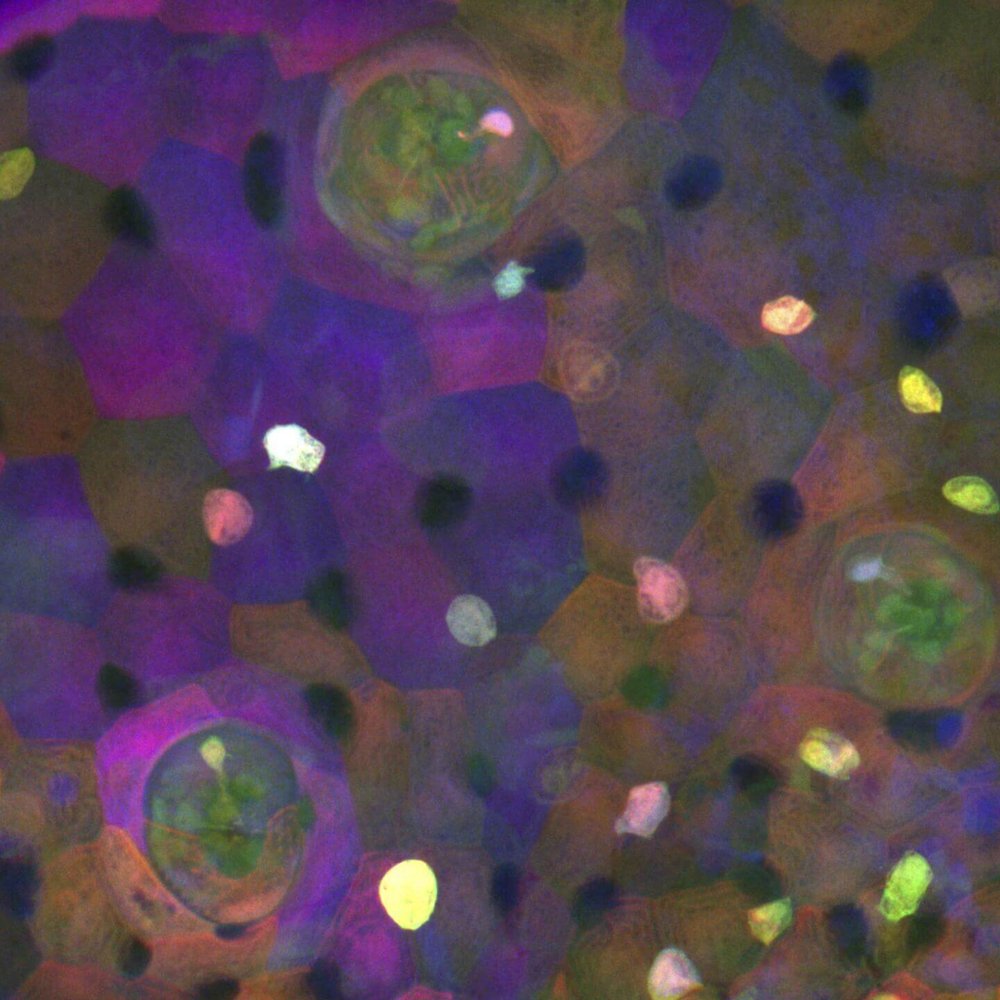 Elusive Cell Type in Fish Sensory Organs Discovered — Hearing Health ...