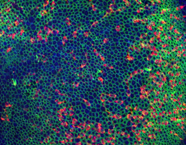 How Beautiful Hearing Loss Research Can Be — Hearing Health Foundation