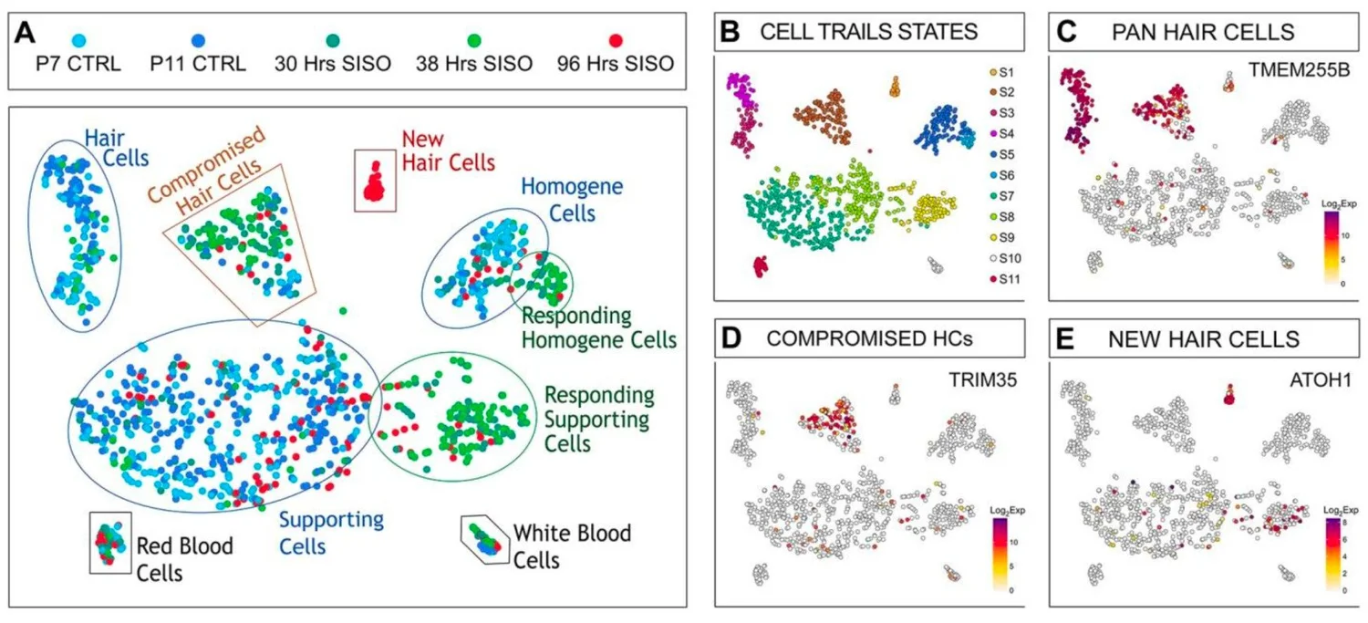 Increasing Our Understanding of Avian Hair Cell Regeneration — Hearing ...