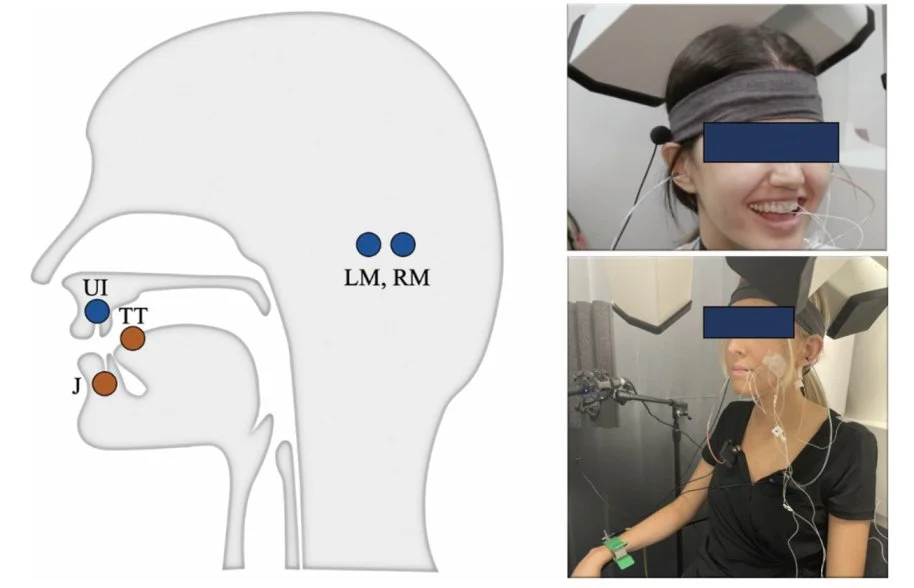 Auditory Input Regulates the Real-Time Coordination of Speech Movements ...