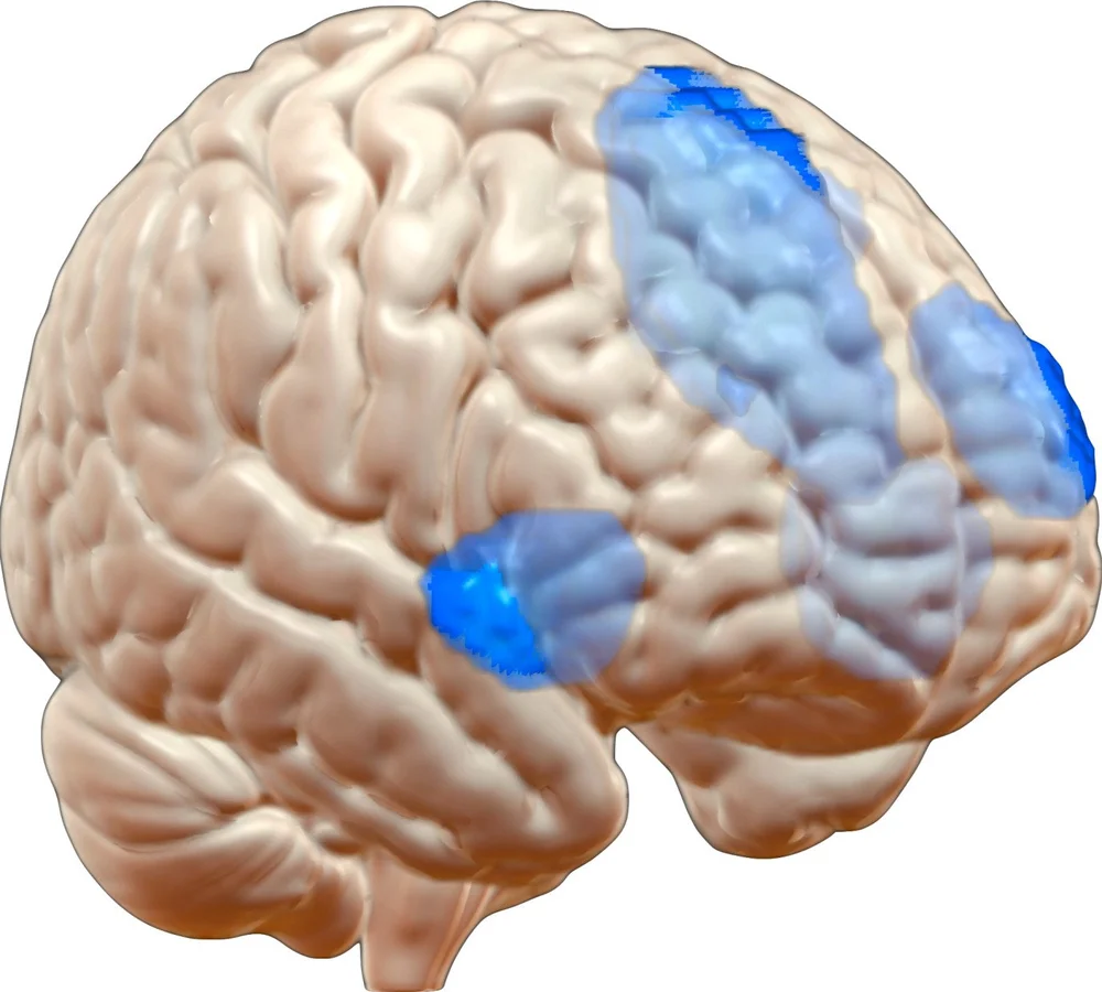 What Is the Cingulo-Opercular Network? — Hearing Health Foundation