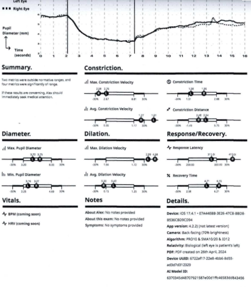 Pupillometry Explanation — Eden Chiropractic