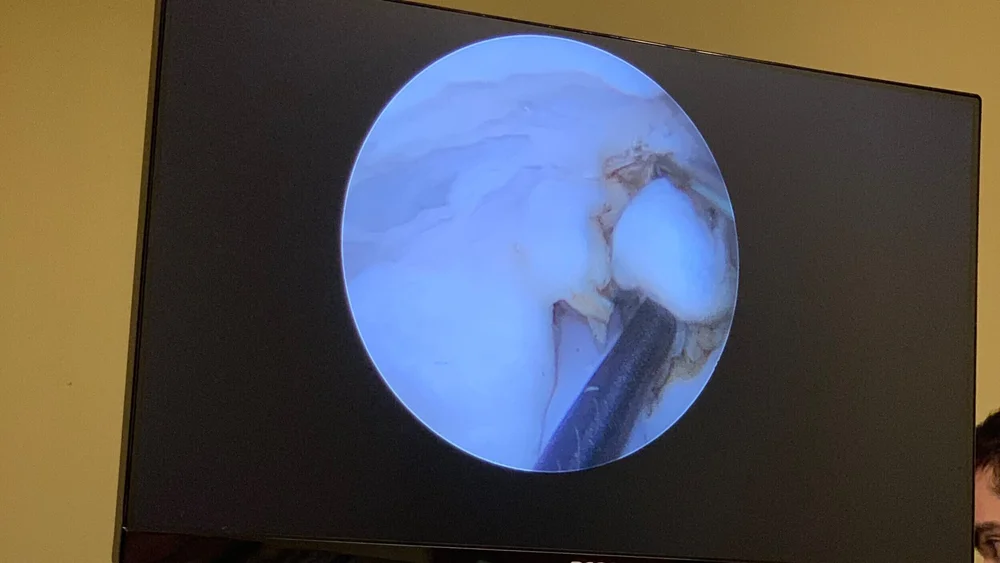 Real Tissue Models™ — Gynesim