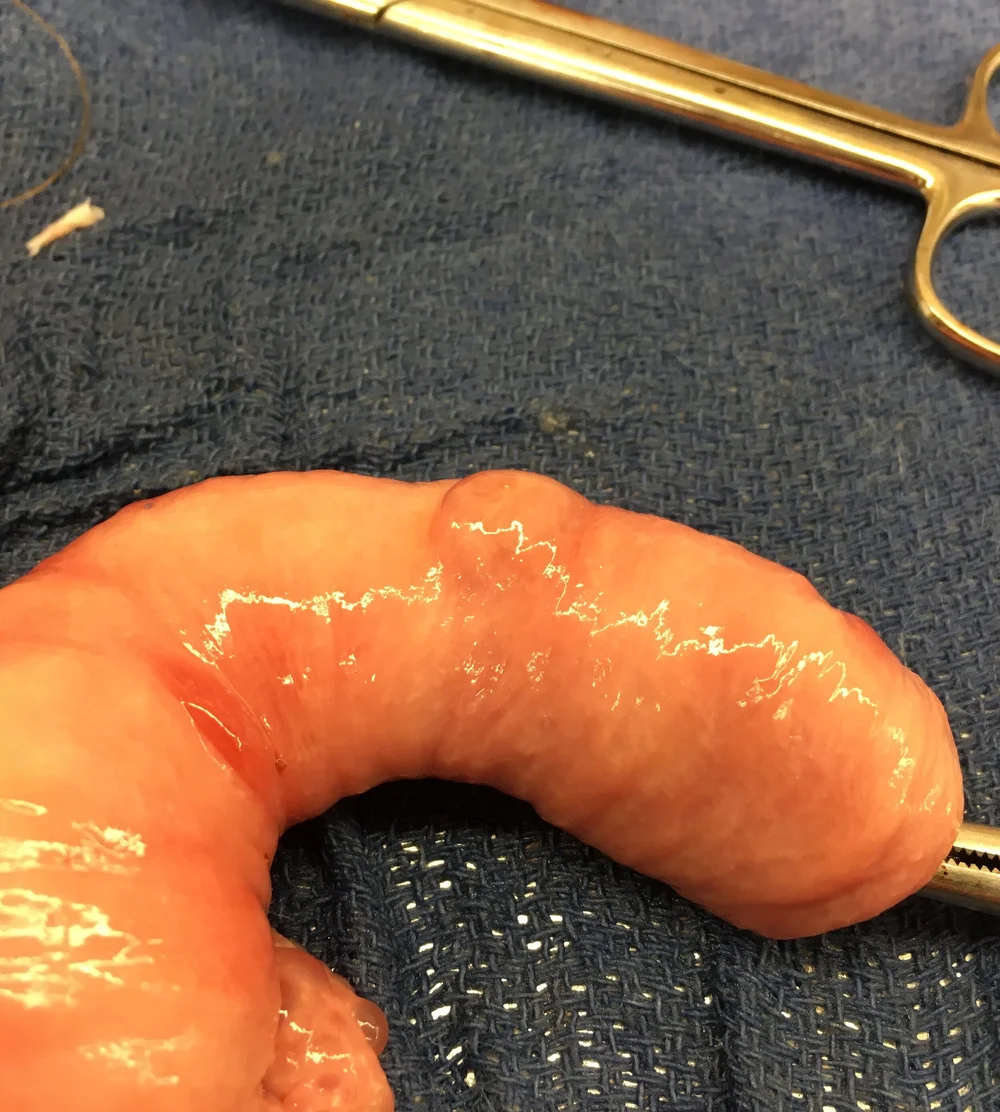 Real Tissue Models™ — Gynesim