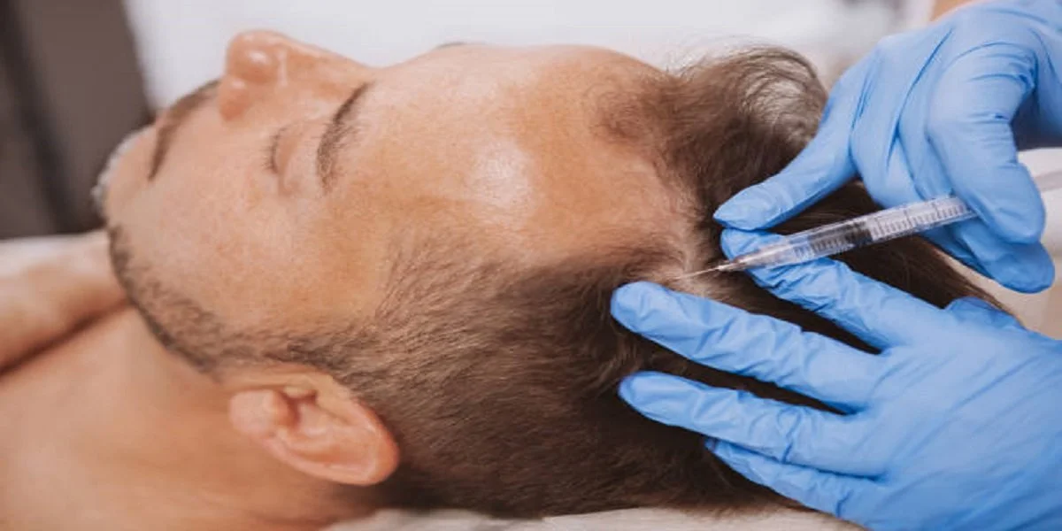 PRP Hair Loss Treatment for Men - Avellina Aesthetics