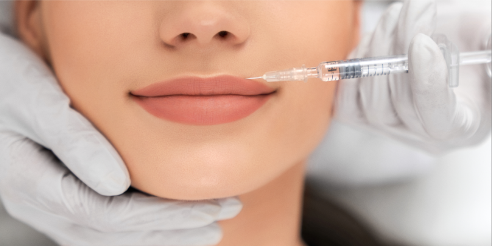 7 Effective Tips for Extending the Life of Your Lip Fillers