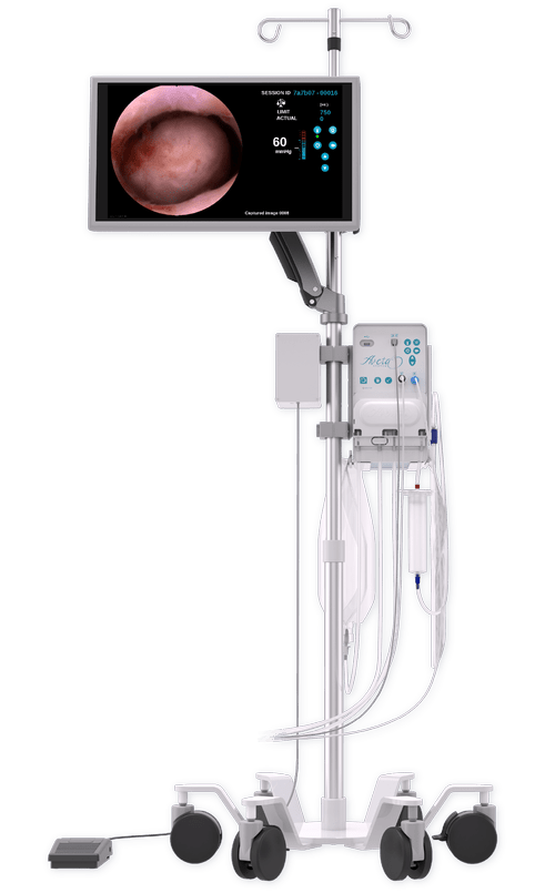 Aveta® System — Aveta® System