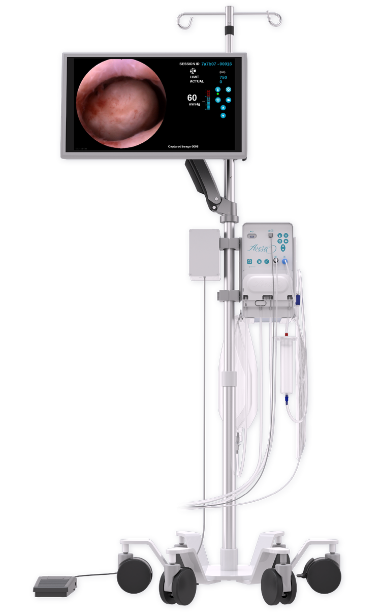 Aveta® System — Aveta® System